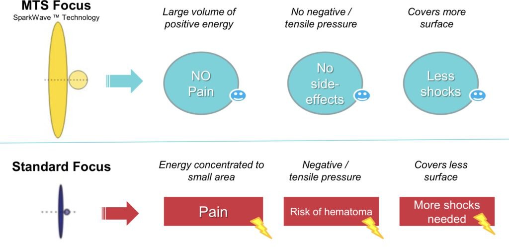 Shock Wave Therapy Mountain View | El Camino Urology Group